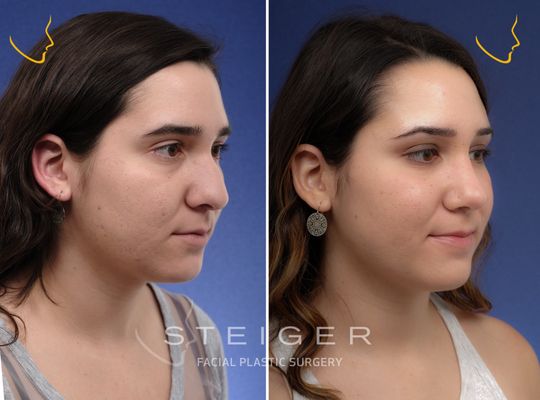 STEIGER FACIAL PLASTIC SURGERY: DR. JACOB D. STEIGER - Updated December ...