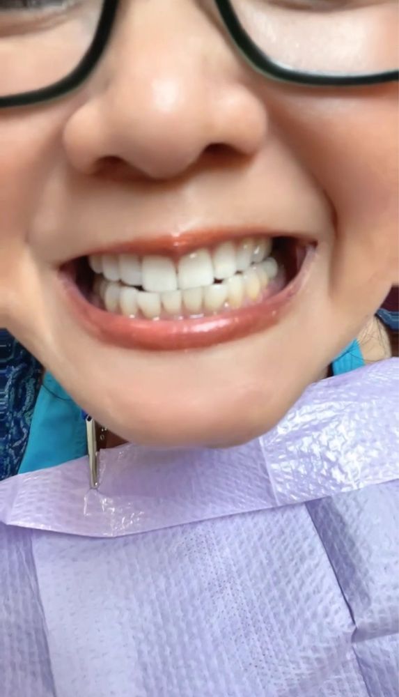 DIAMOND DENTAL - Updated January 2026 - 43 Photos & 54 Reviews - 2790 ...