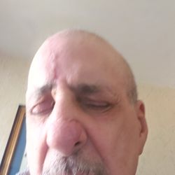 GREGORY W. BORMES, MD - 12 Photos - 1800 Mulberry St, Scranton, PA - Yelp