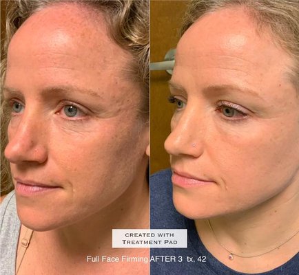 ENT SURGERY GROUP - Updated January 2026 - 32 Photos - 425 N 21st St ...