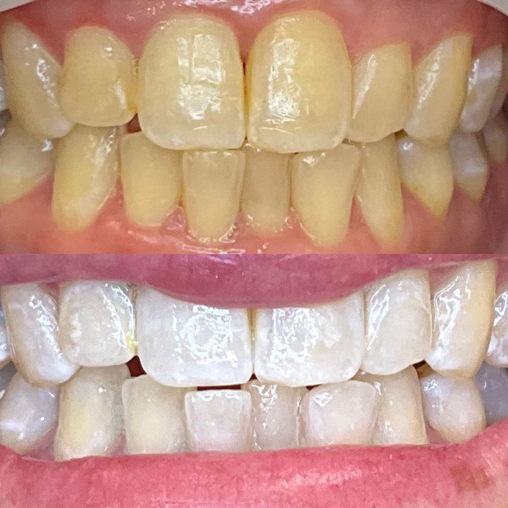 WE WHITEN - Updated August 2025 - 7501 Holly Ave NE, Albuquerque, New ...