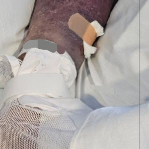 RML SPECIALTY HOSPITAL - Updated September 2025 - 3435 W Van Buren St ...