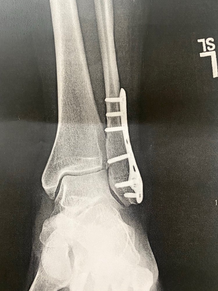 KANSAS CITY BONE & JOINT CLINIC - Updated December 2025 - 33 Reviews ...