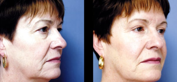 JOSEPH R BARNTHOUSE, MD - Updated May 2025 - 47 Photos - 1010 ...