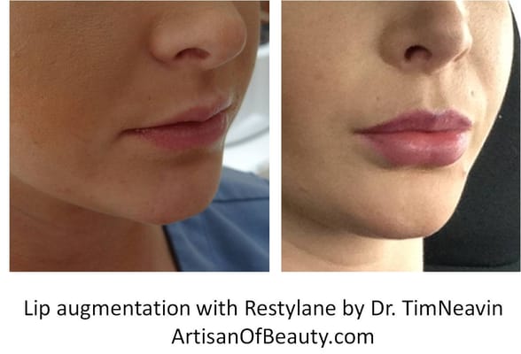 TIM NEAVIN - Updated December 2025 - 56 Photos & 46 Reviews - 421 N ...