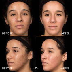 JASON EMER, MD - 914 Photos & 365 Reviews - Dermatologists - 9201 ...