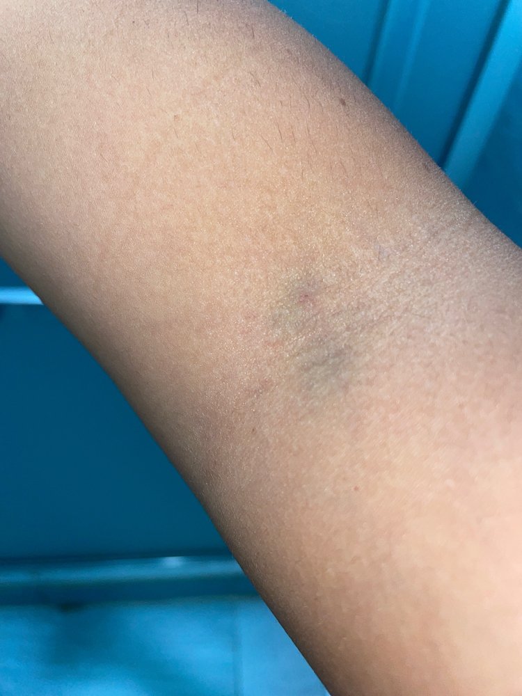 THE IV DOC - Updated January 2026 - 13 Photos & 24 Reviews - Los Angeles, California - IV ...