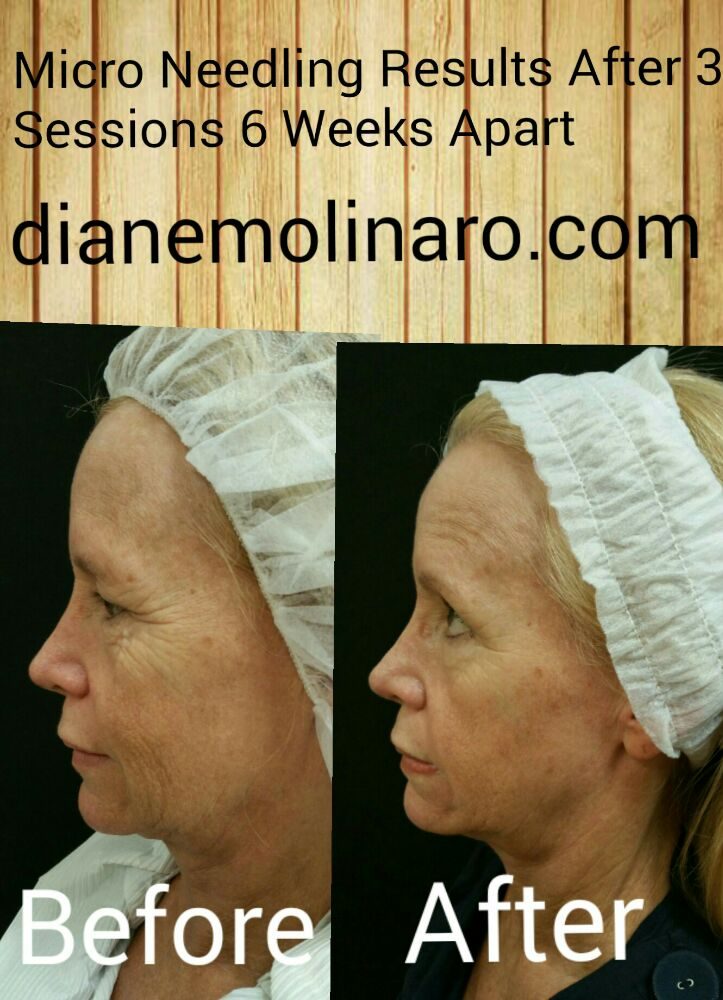 DIANE MOLINARO CPCP PERMANENT COSMETICS - Updated July 2025 - 17 Photos ...