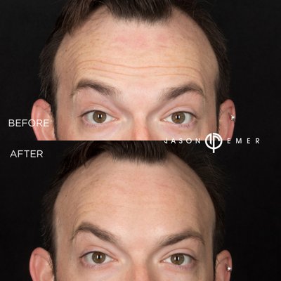 JASON EMER, MD - 1006 Photos & 419 Reviews - 9201 Sunset Blvd, West ...