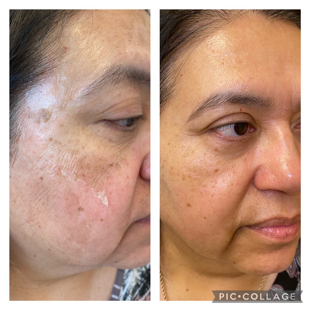 BOMBSHELL SKIN CLINIC - Updated March 2025 - 16 Photos - 20330 Huebner ...