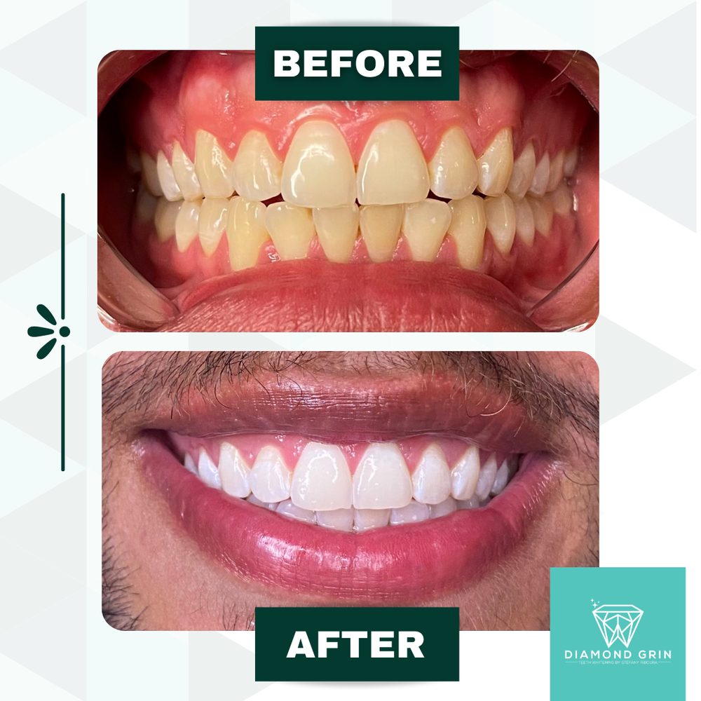 DIAMOND GRIN - Request an Appointment - San Mateo, California - Teeth ...