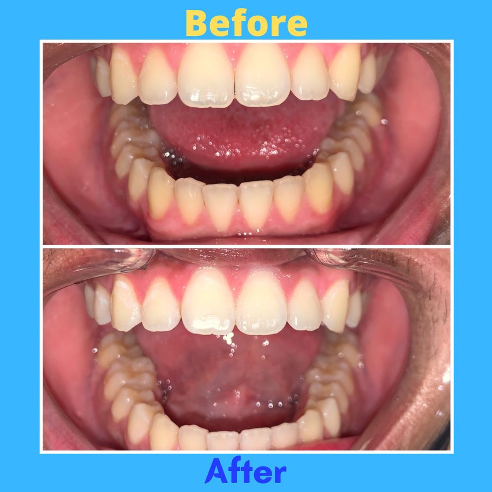 TOOTHIFY - La Mirada, California - Teeth Whitening - Phone Number - Yelp