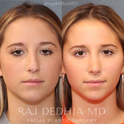 RAJ DEDHIA MD FACIAL PLASTIC SURGERY - Updated December 2025 - 13 ...