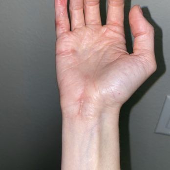 THE MINIMALLY INVASIVE HAND INSTITUTE - Updated July 2024 - 59 Photos ...