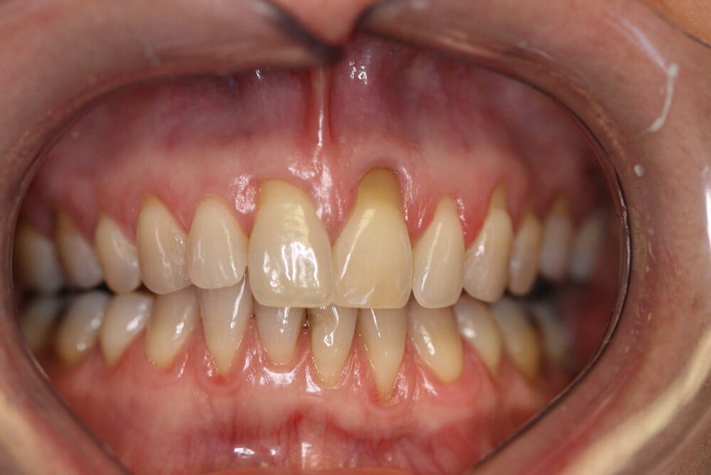 WILLIAM W LIN, DDS - 11 Photos & 19 Reviews - 5405 Baldwin Ave, Temple ...