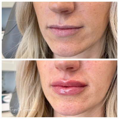 MERIDIAN MEDICAL SPA - 80 Photos & 22 Reviews - 24850 S Tamiami Trl ...