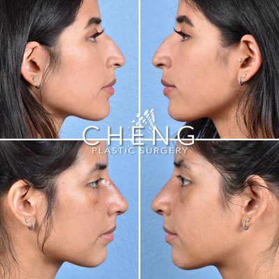 CHENG PLASTIC SURGERY - Updated December 2025 - 153 Photos & 439 ...