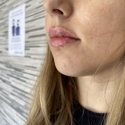 ALLIANCE HEALTH CHOICE - 334 Photos & 414 Reviews - Medical Spas - 1740 ...