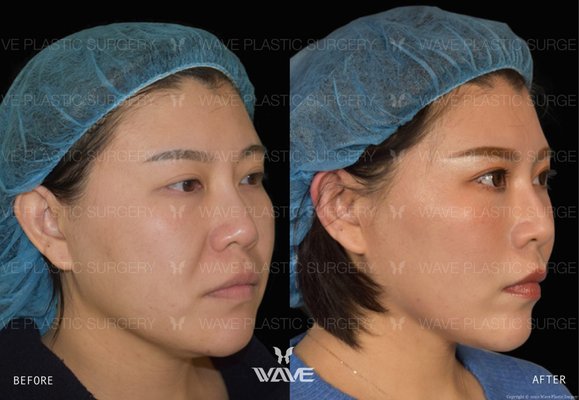 WAVE PLASTIC SURGERY & AESTHETIC LASER CENTER - 73 Photos & 84 Reviews ...
