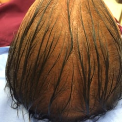 KIMBERLY COCKERHAM, MD - 30 Photos - Cosmetic Surgeons - 36 Yokuts Ave ...