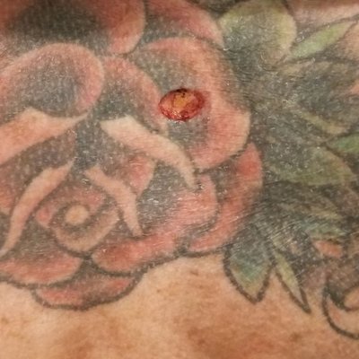 CENTER FOR DERMATOLOGY & PLASTIC SURGERY - Updated January 2026 - 25 ...