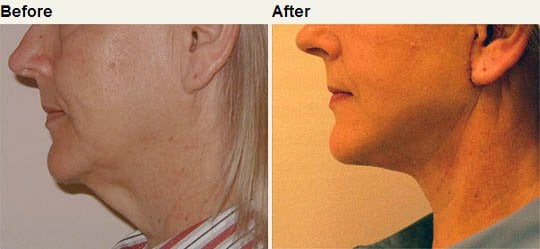 SOHEILA ROSTAMI, MD, FAAO, FAACS - Updated December 2025 - 19 Photos ...