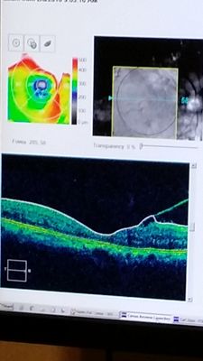 SOUTH COAST RETINA CENTER - Updated December 2025 - 38 Photos & 100 ...