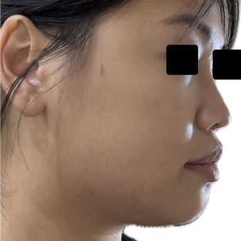 DONALD B YOO, MD, FACS - Updated March 2025 - 380 Photos & 248 Reviews ...