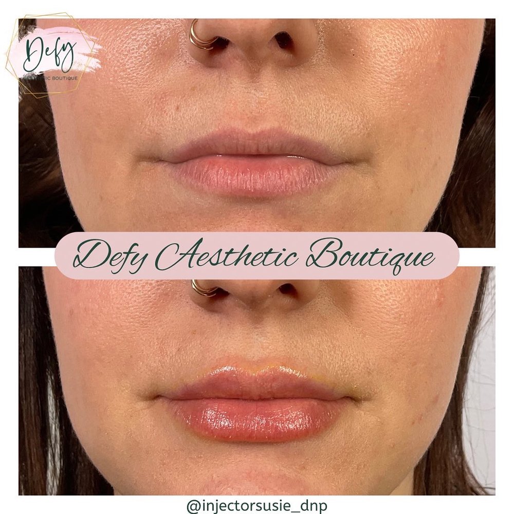 DEFY AESTHETIC BOUTIQUE - Updated January 2026 - 29 Photos - 42450 W 12 ...