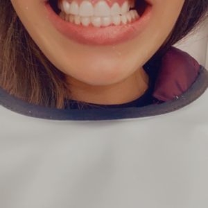 PRECISION FAMILY DENTAL OF MERCED - 18 Reviews - Cosmetic Dentists ...