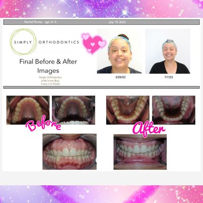 SIMPLY ORTHODONTICS - Updated October 2025 - 125 Photos & 290 Reviews - 6246 Irvine Blvd, Irvine ...