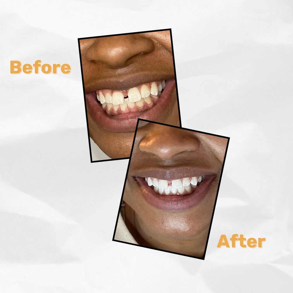 THE ROYAL SMILE | Request an Appointment - Milford Mill, Maryland ...