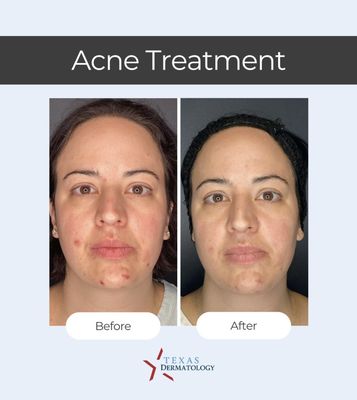 TEXAS DERMATOLOGY - NEW BRAUNFELS - Updated May 2026 - 21 Photos & 14 ...