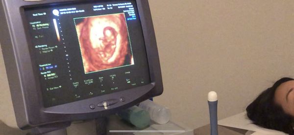 THOMAS TRI QUACH, M.D. OBGYN - Updated December 2025 - 27 Photos & 74 ...