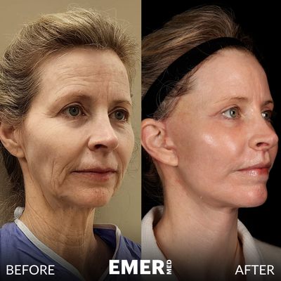 JASON EMER, MD - Updated July 2025 - 1158 Photos & 512 Reviews - 9201 ...