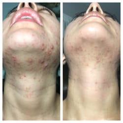 GEORGE HSIEH, MD - ADVANCED DERMATOLOGY & SKIN SURGERY - 14 Photos & 98 ...