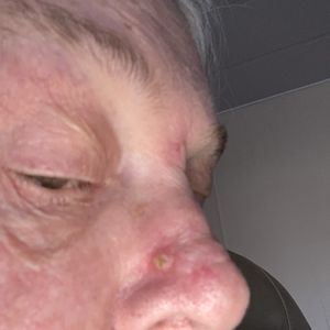 KANSAS CITY SKIN & CANCER CENTER - Updated October 2025 - 10 Reviews ...