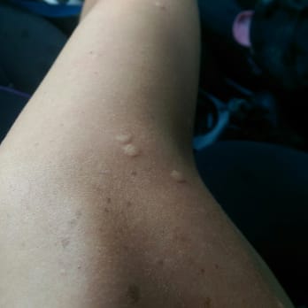 MAYOR ROSCOE WARREN MUNICIPAL PARK - Updated September 2024 - 71 Photos ...