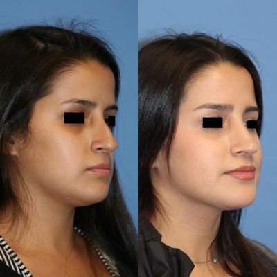 EVAN RANSOM, MD - Updated December 2025 - 126 Photos & 241 Reviews ...