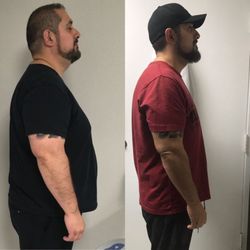 VANEITY MEDICAL WEIGHT LOSS - 512 Photos & 174 Reviews - 3580 Grand Ave ...