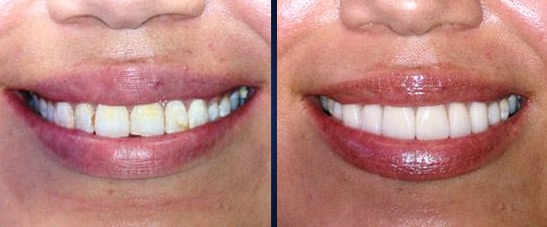 MARK WEITZMAN, DDS - Updated October 2025 - 40 Photos & 53 Reviews ...