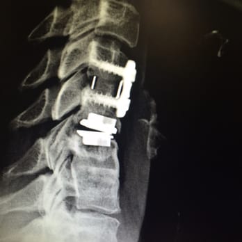 LUNA SPINE AND ORTHOPAEDIC SURGERY - Updated January 2026 - 28780 ...