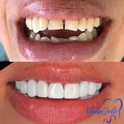 DENTAL DESIGN SMILE - Updated June 2025 - 41 Photos & 51 Reviews ...