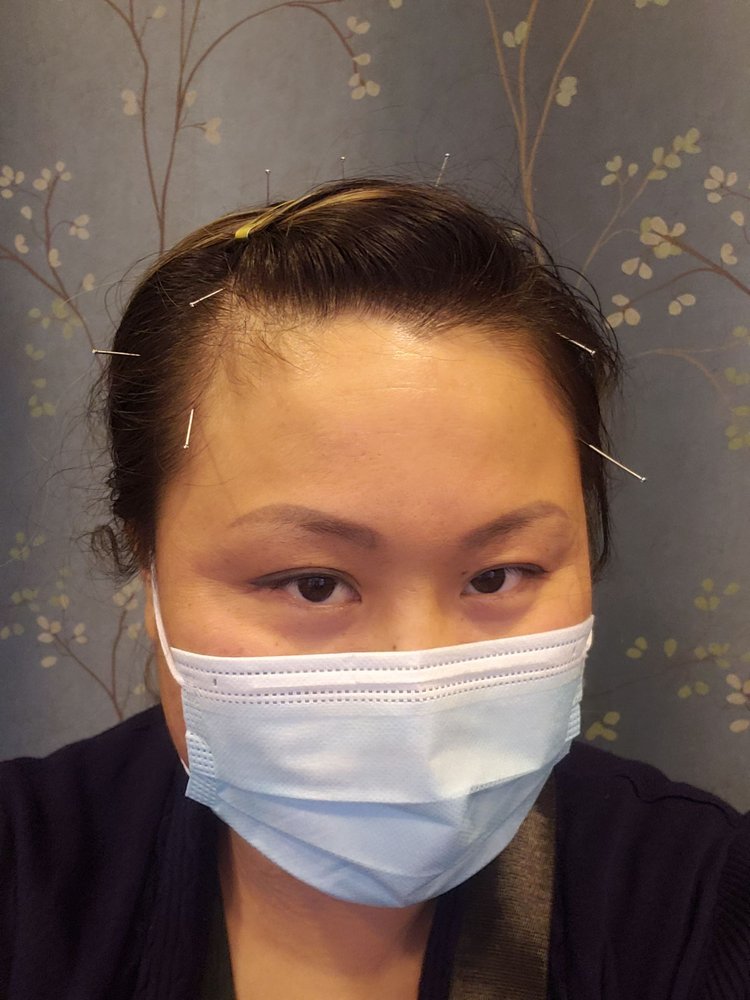 LAURA ACUPUNCTURE CLINIC - Updated January 2026 - 40 Photos & 27 ...