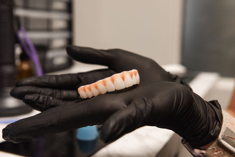 SMILE NOW RENO DENTURES AND IMPLANTS - Updated October 2025 - 58 Photos ...