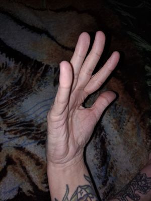 THE MINIMALLY INVASIVE HAND INSTITUTE - Updated July 2025 - 68 Photos ...