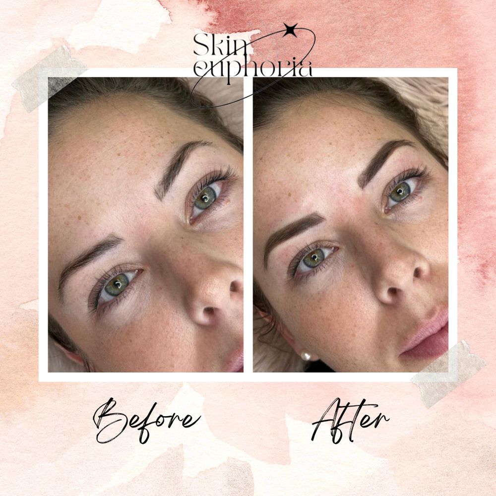 SKIN EUPHORIA - Updated January 2025 - 14 Photos - 3500 Fifth Ave, San ...