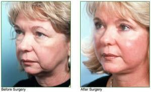 ROGER A ALLCROFT, MD FACS - Updated May 2026 - 14 Photos & 11 Reviews ...