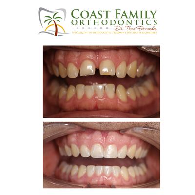 TRACI R FERNANDES, DDS - COAST FAMILY ORTHODONTICS - Updated December ...