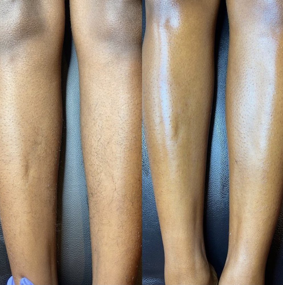 FULL MOON ESTHETICS - Updated June 2025 - 9013 Westchester Cir, Tampa ...